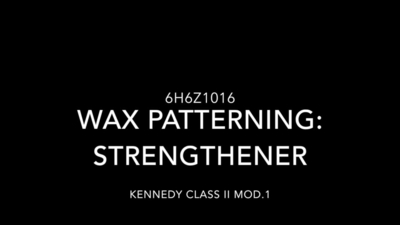 Kennedy Class II Mod. 1 - Wax patterning: Strengthener - mmutube