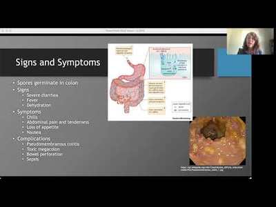 C. diff Presentation - BYU-Idaho