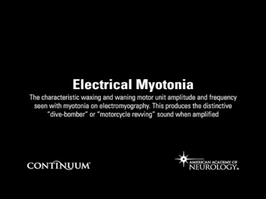 CONTINUUM: Lifelong Learning in Neurology