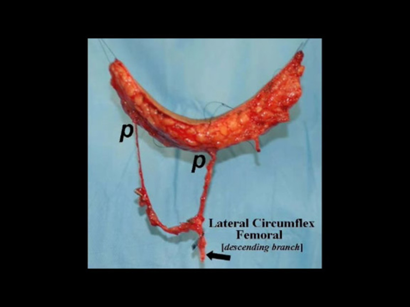 Plastic and Reconstructive Surgery