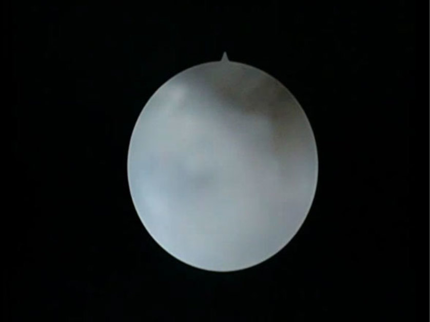 Techniques in Hand & Upper Extremity Surgery