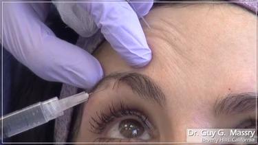 Video Gallery : Plastic and Reconstructive Surgery