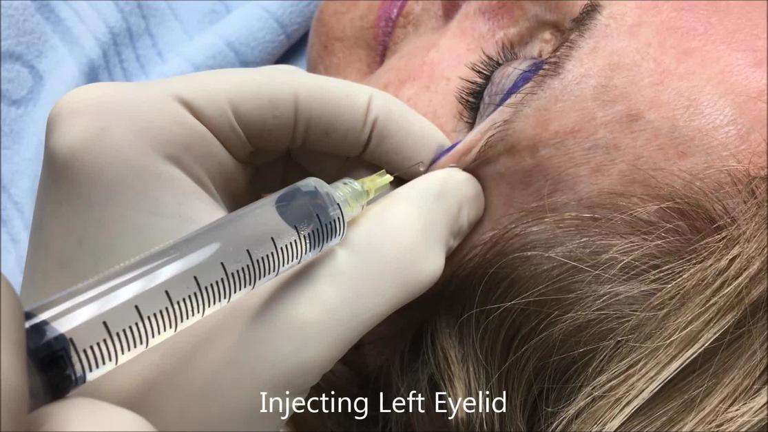 Plastic and Reconstructive Surgery – Global Open