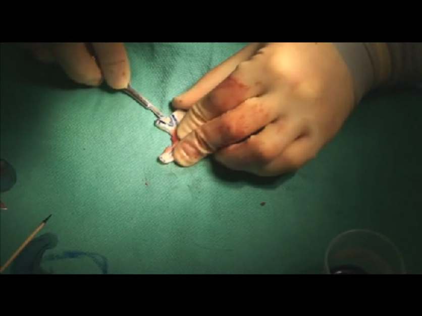 Plastic and Reconstructive Surgery