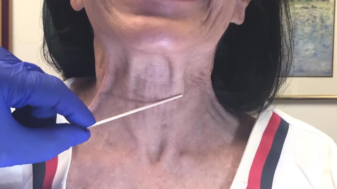 Plastic and Reconstructive Surgery – Global Open