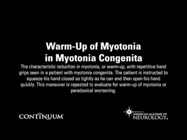 CONTINUUM: Lifelong Learning in Neurology