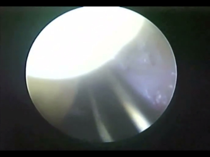 Techniques in Hand & Upper Extremity Surgery