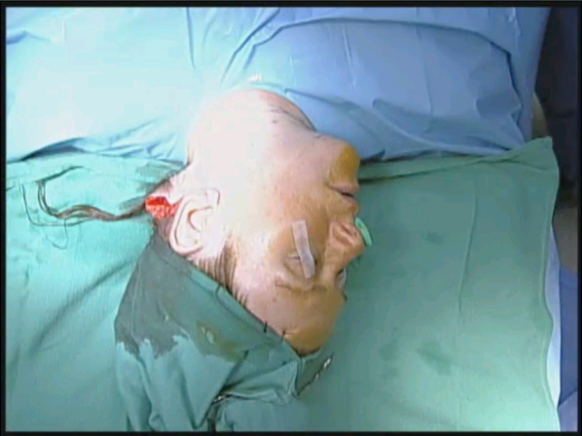 Plastic and Reconstructive Surgery