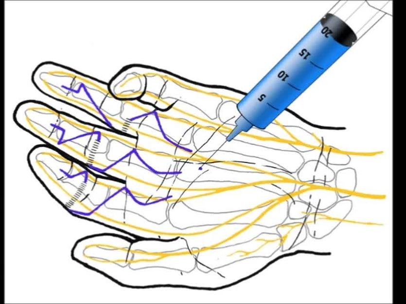 Plastic and Reconstructive Surgery – Global Open