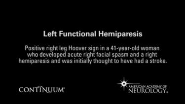 CONTINUUM: Lifelong Learning in Neurology