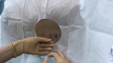 Video Gallery : Anesthesia & Analgesia