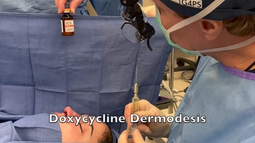 Plastic and Reconstructive Surgery