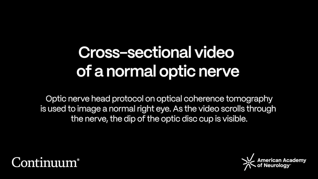 CONTINUUM: Lifelong Learning in Neurology