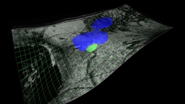 Video Gallery : RETINA