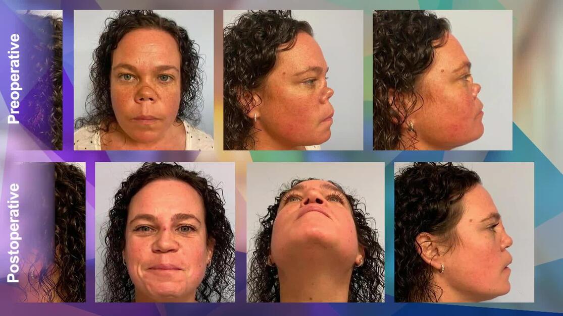 Plastic and Reconstructive Surgery