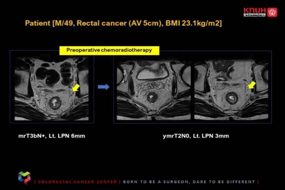 Diseases of the Colon & Rectum