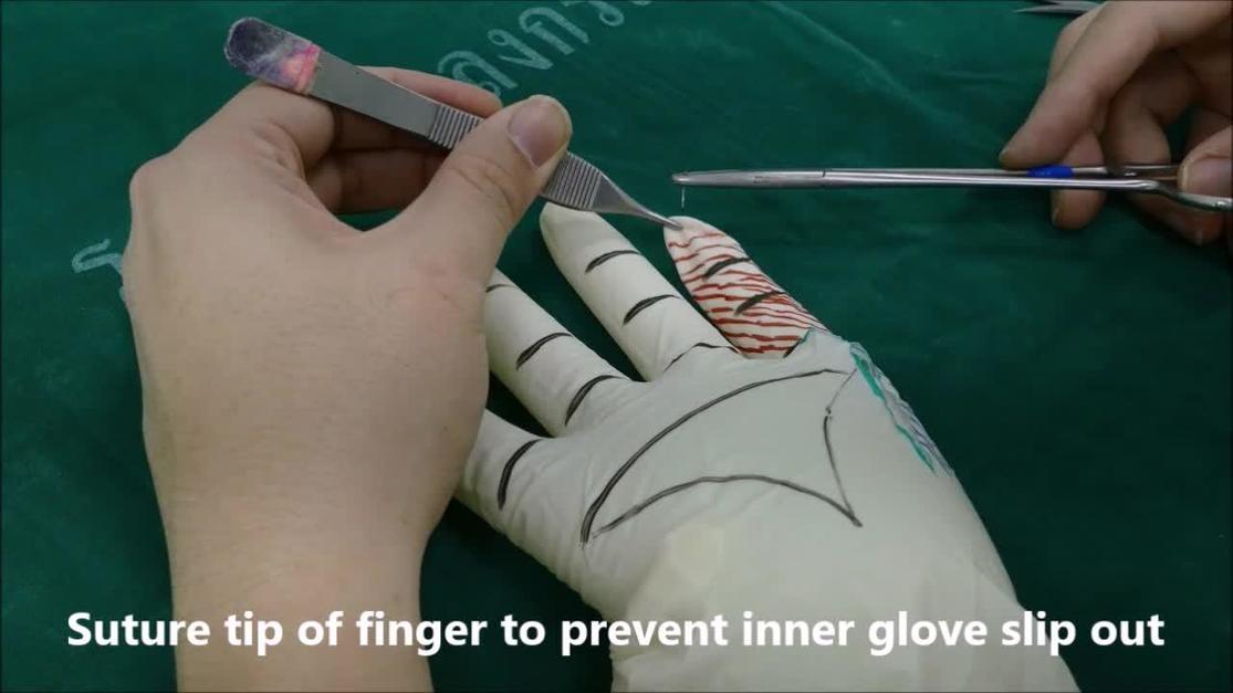 Plastic and Reconstructive Surgery