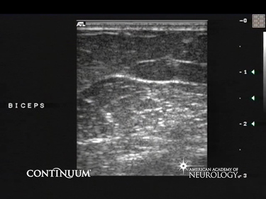 CONTINUUM: Lifelong Learning in Neurology