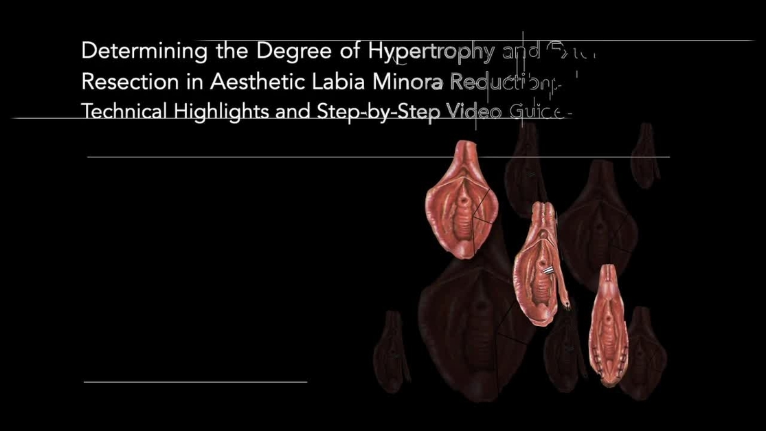 Plastic and Reconstructive Surgery