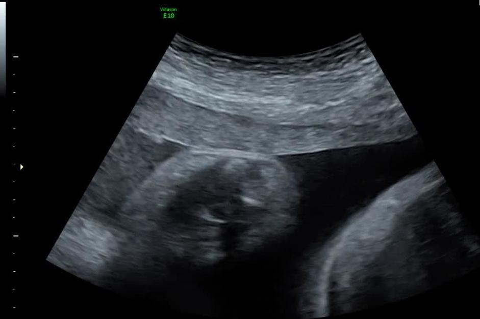 Obstetrics & Gynecology