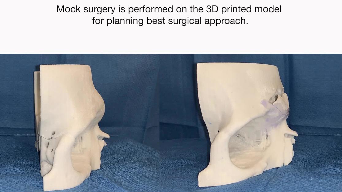 Plastic and Reconstructive Surgery