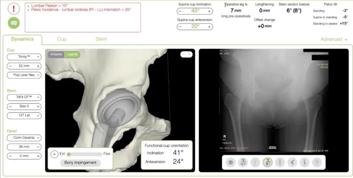 JAAOS - Journal of the American Academy of Orthopaedic Surgeons