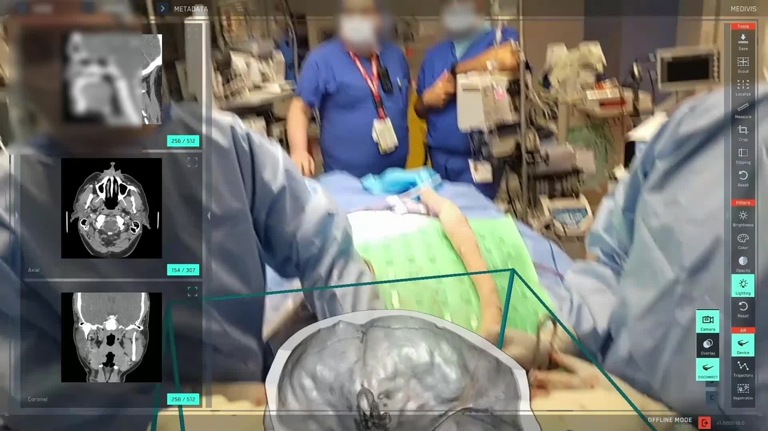 Plastic and Reconstructive Surgery – Global Open