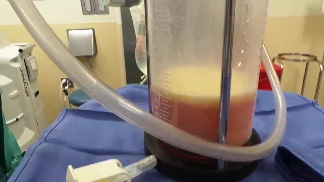 Plastic and Reconstructive Surgery