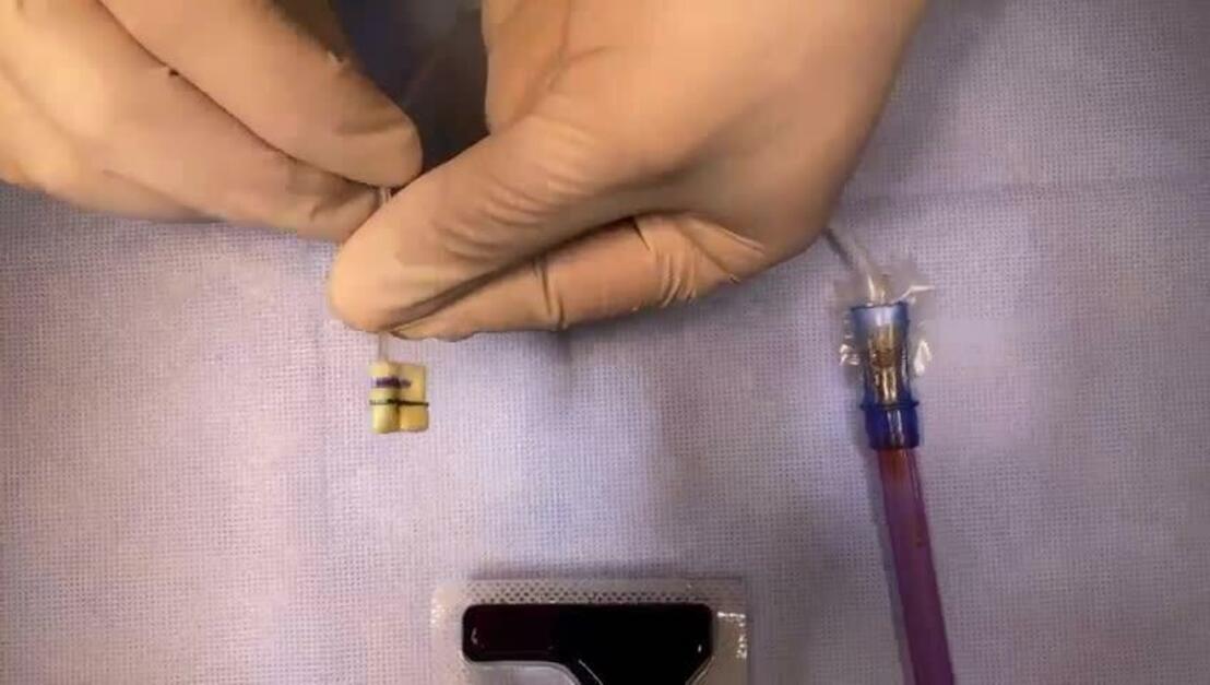 Plastic and Reconstructive Surgery – Global Open