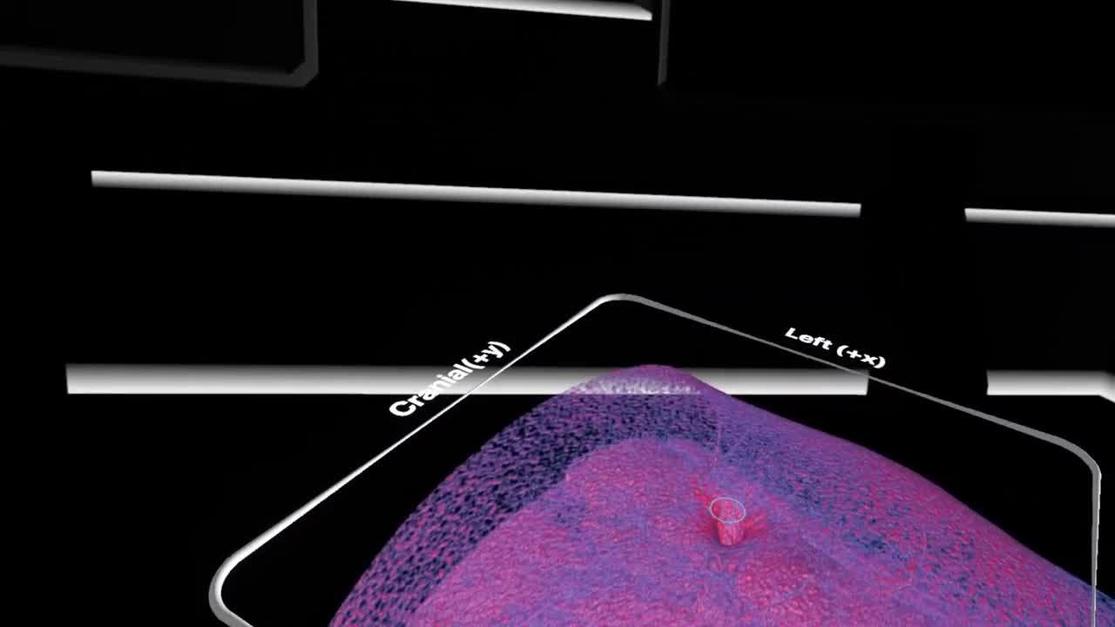 Plastic and Reconstructive Surgery – Global Open