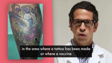 Video Gallery : Plastic and Reconstructive Surgery – Global Open