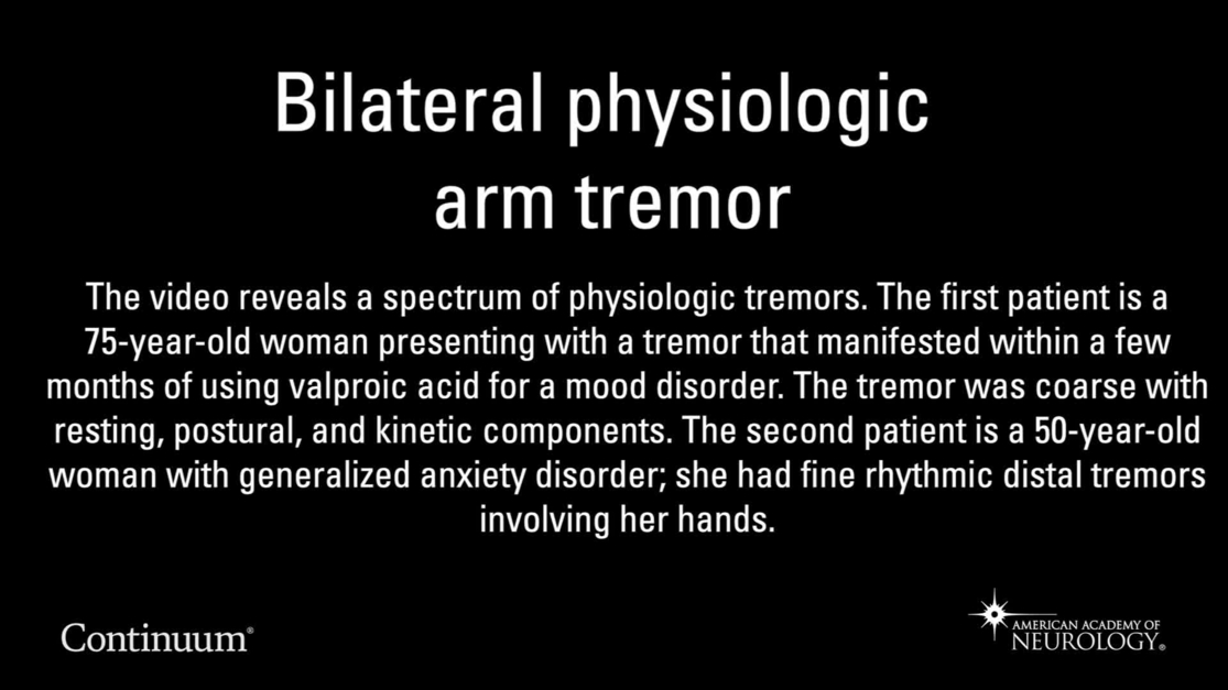 CONTINUUM: Lifelong Learning in Neurology