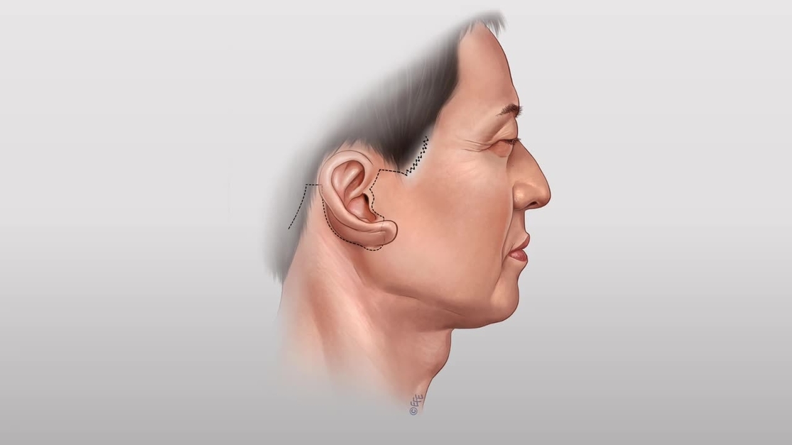 Plastic and Reconstructive Surgery
