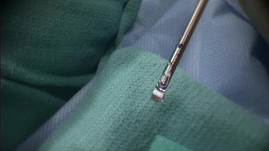 Plastic and Reconstructive Surgery