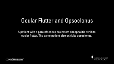 CONTINUUM: Lifelong Learning in Neurology