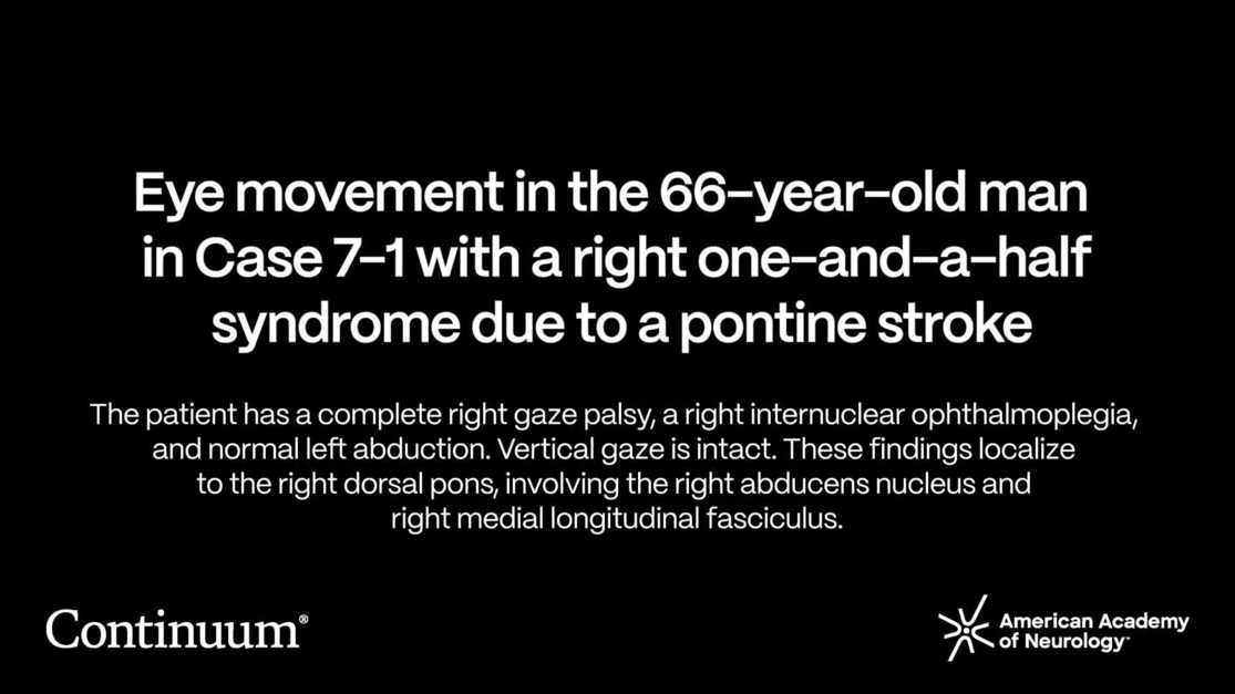 CONTINUUM: Lifelong Learning in Neurology