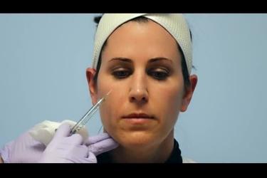 Video Gallery : Plastic and Reconstructive Surgery