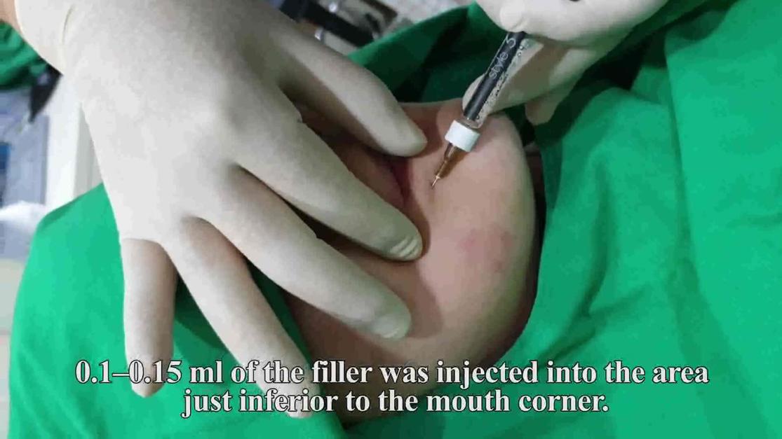 Plastic and Reconstructive Surgery