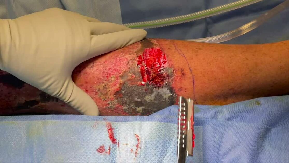 Plastic and Reconstructive Surgery