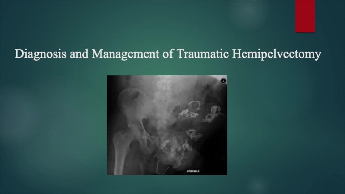 JAAOS - Journal of the American Academy of Orthopaedic Surgeons