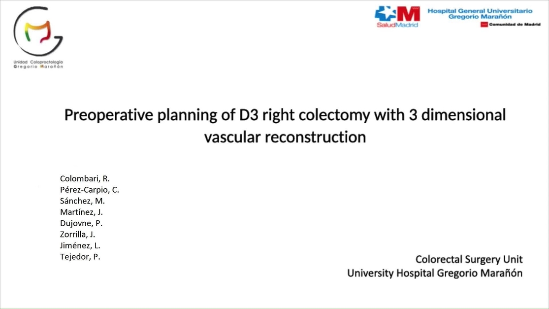 Diseases of the Colon & Rectum