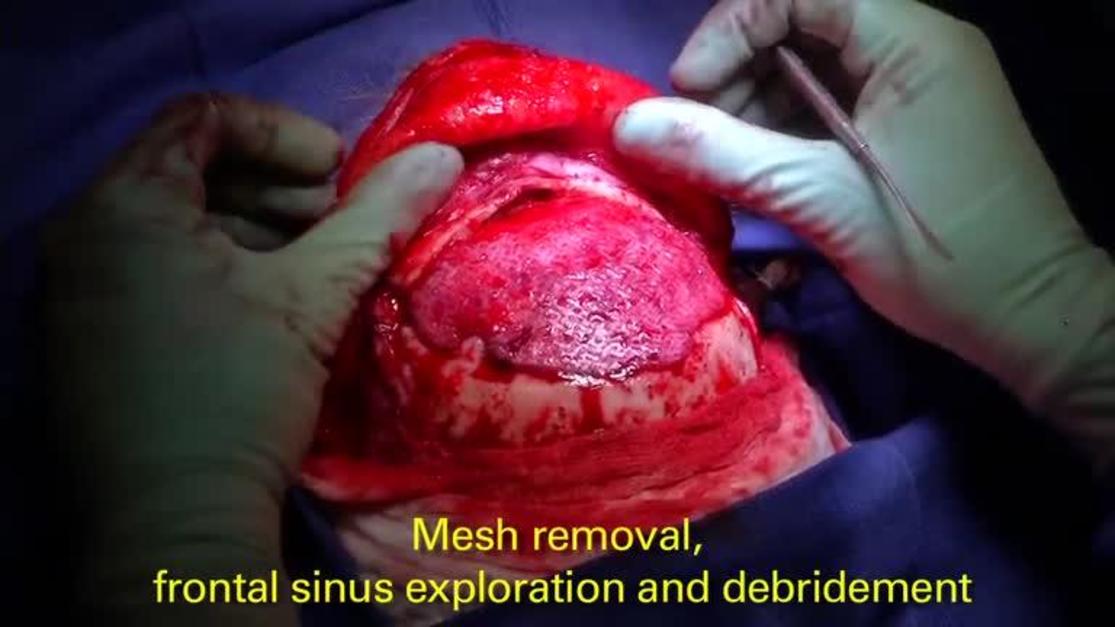 Plastic and Reconstructive Surgery