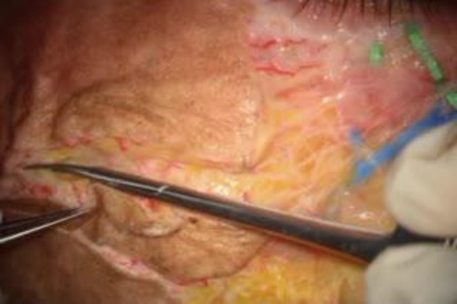 Plastic and Reconstructive Surgery