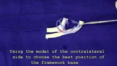 Video Gallery : Plastic and Reconstructive Surgery