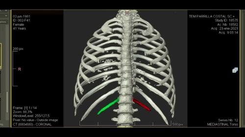 Plastic and Reconstructive Surgery – Global Open