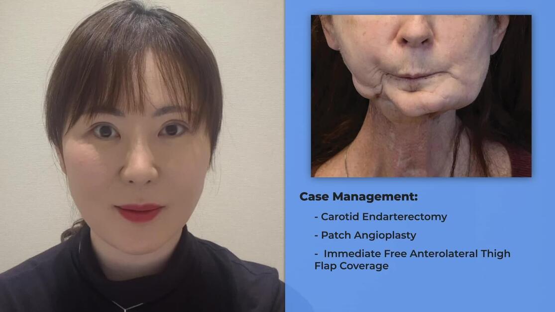 Plastic and Reconstructive Surgery – Global Open