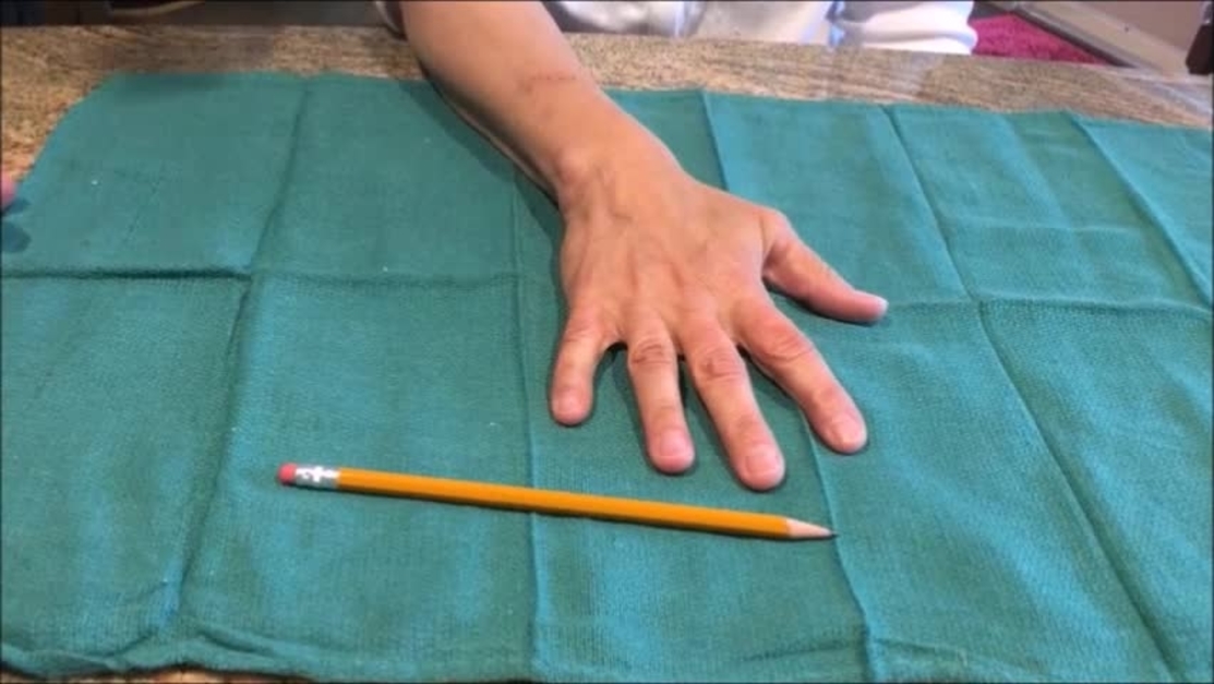 Plastic and Reconstructive Surgery – Global Open