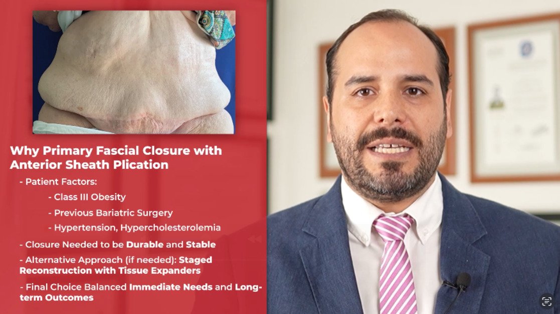 Plastic and Reconstructive Surgery – Global Open