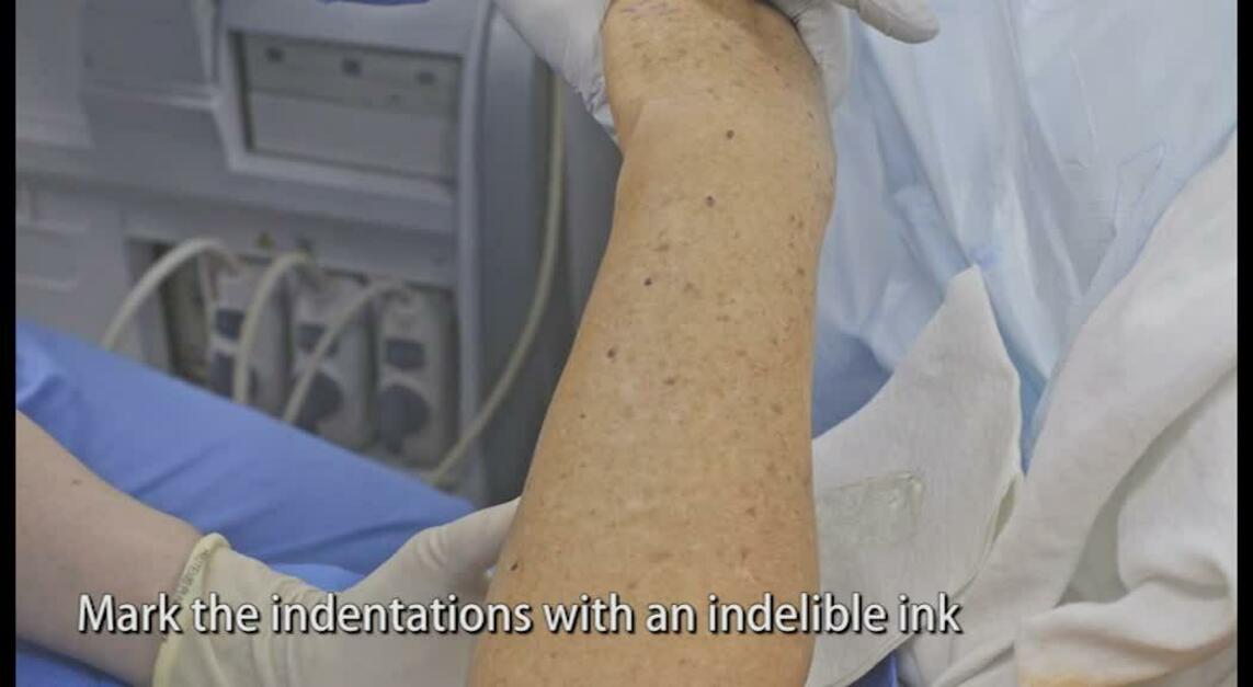 Plastic and Reconstructive Surgery – Global Open