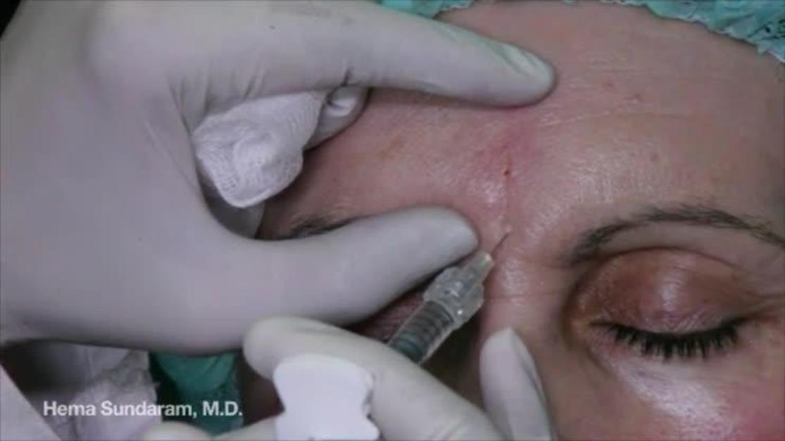 Plastic and Reconstructive Surgery